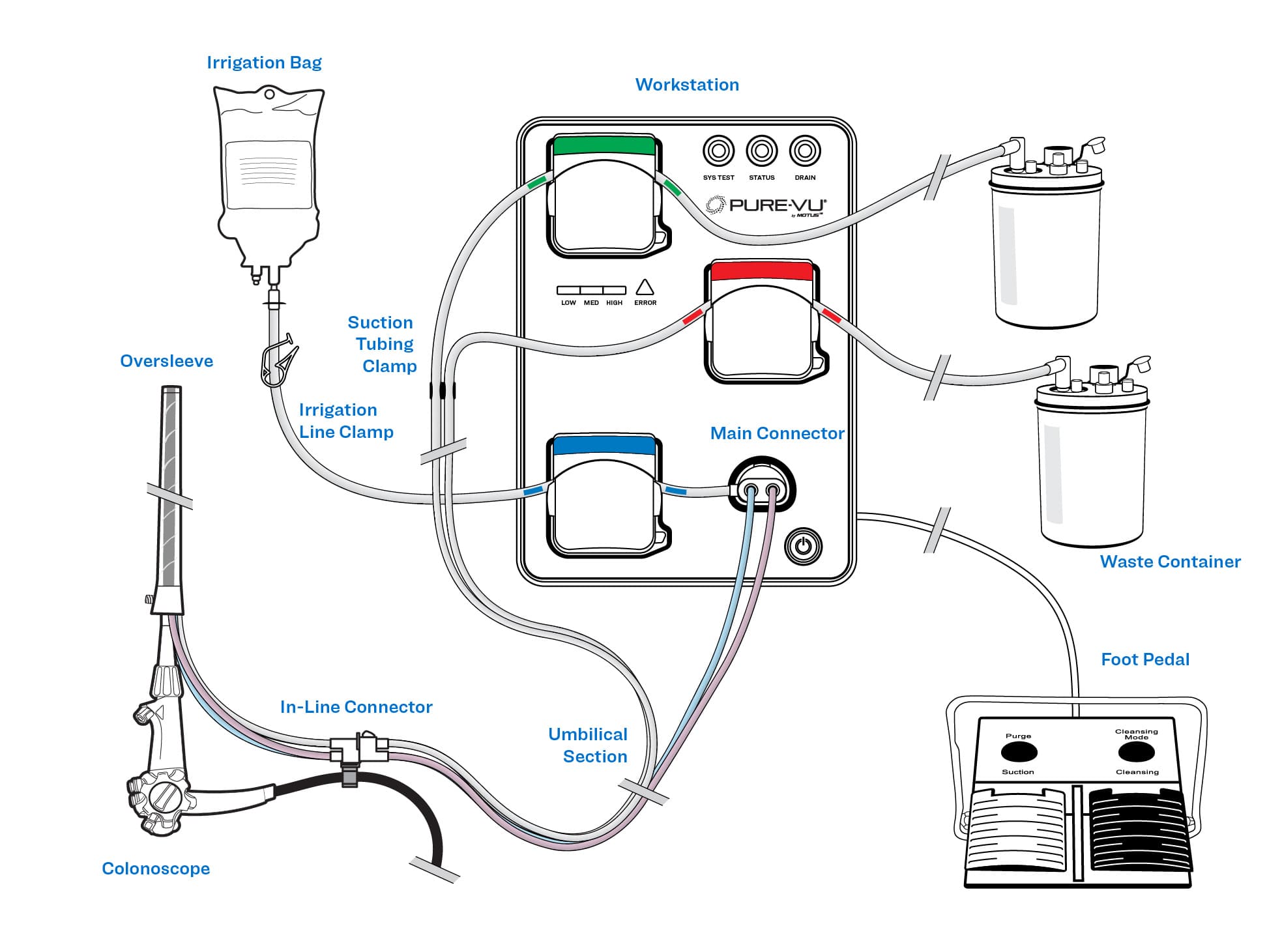 Helpful Hints | Cleansing Poorly Prepped Colons | Motus GI