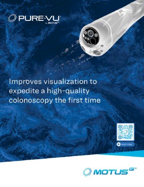 Improve Visualization of the Colon & Quality of Colonoscopy