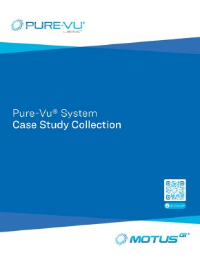 Improve Visualization of the Colon & Quality of Colonoscopy
