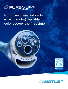 Improve Visualization of the Colon & Quality of Colonoscopy